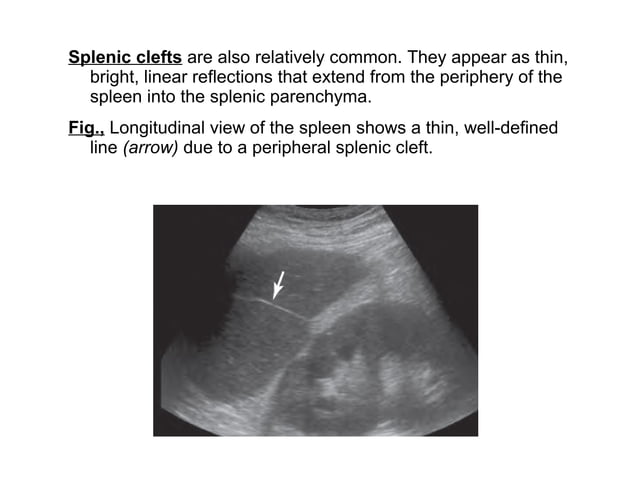 Spleen Ultrasound anatomy structure scanning techniques and pathologies