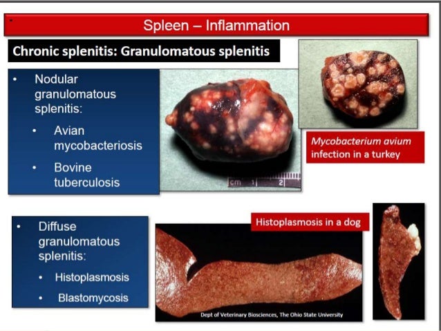 Spleen and lymph nodes