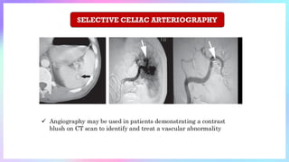spleen and pancreatic injury grading and management.pdf