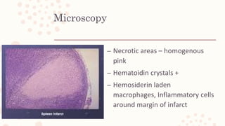 SPLENIC INFARCT, CVC SPLEEN & LUNGS PATHOLOGY PRACTICAL CLASS FOR MBBS ...