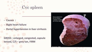 SPLENIC INFARCT, CVC SPLEEN & LUNGS PATHOLOGY PRACTICAL CLASS FOR MBBS ...