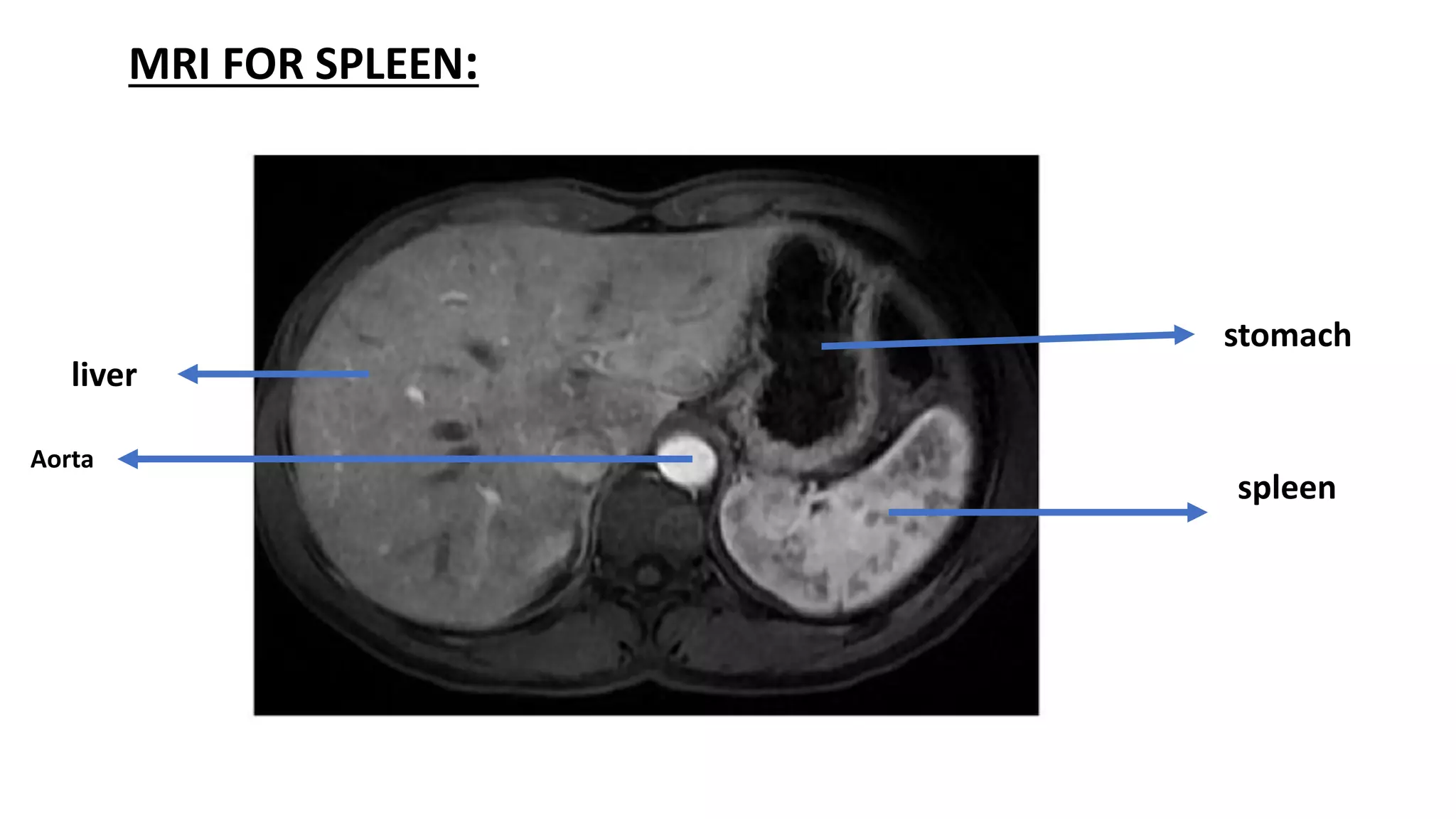 Spleen dr aya.pdf