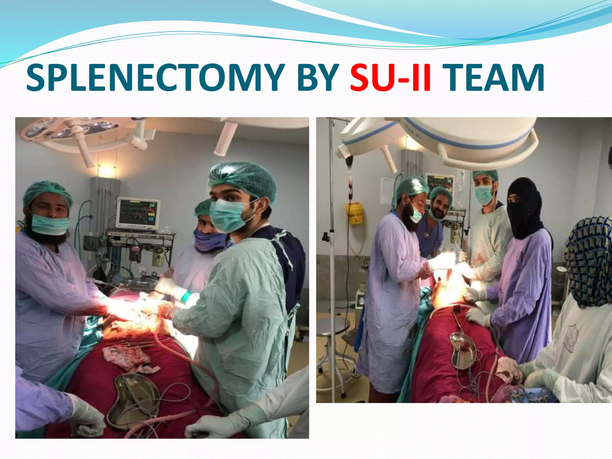 Spleenectomy | PPTX