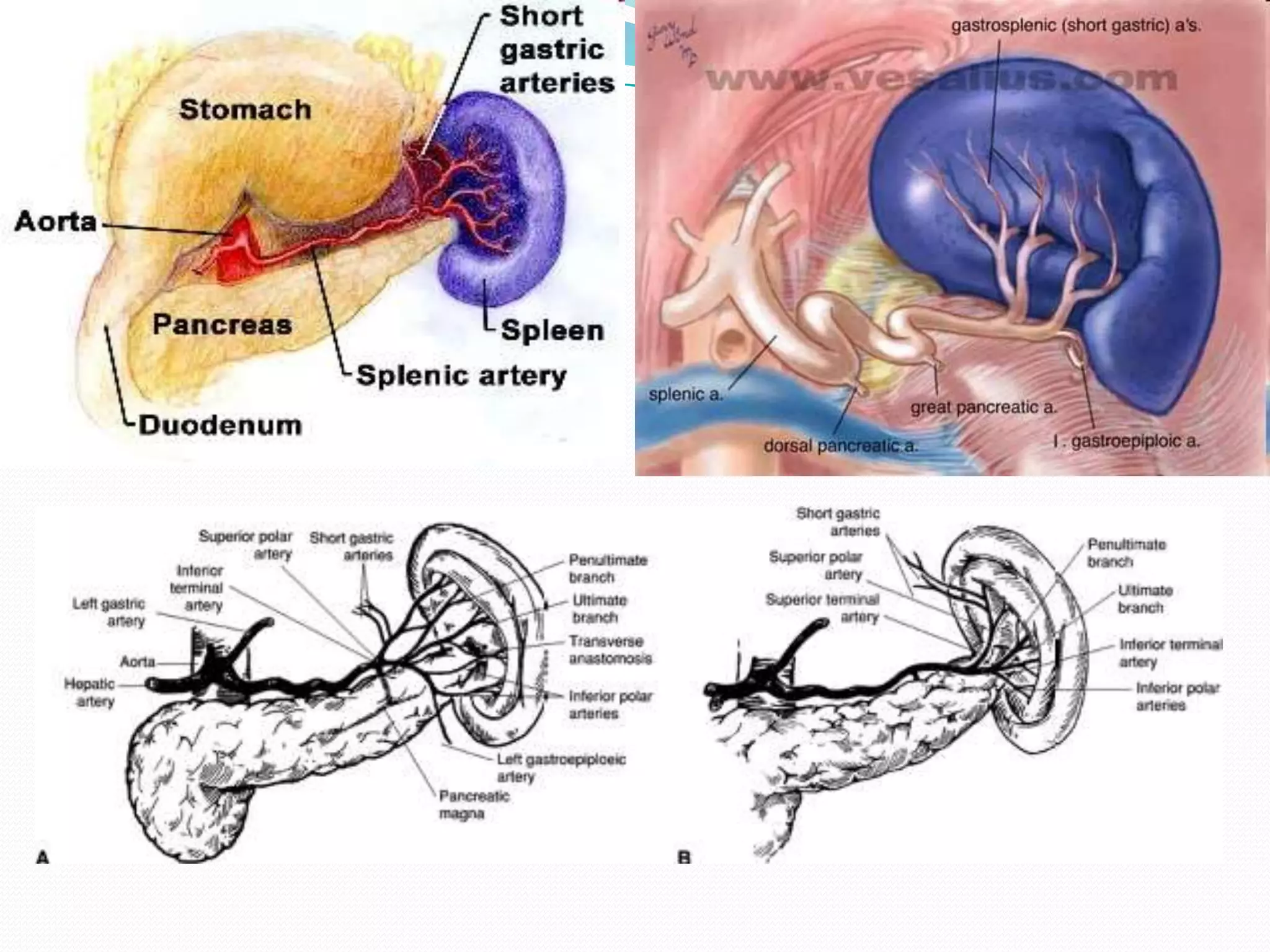Spleenectomy | PPTX