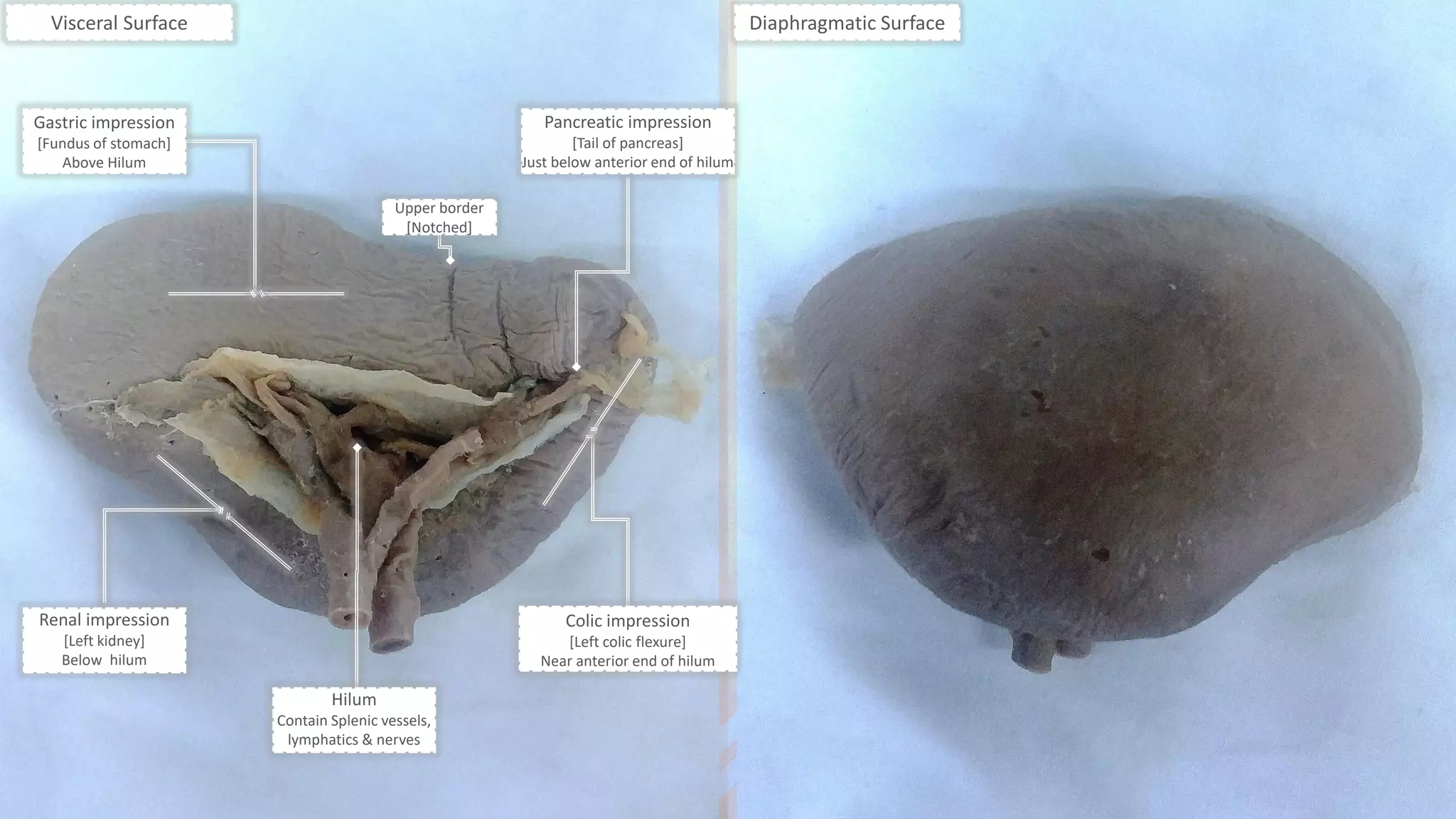 Spleen lab summary | PPT