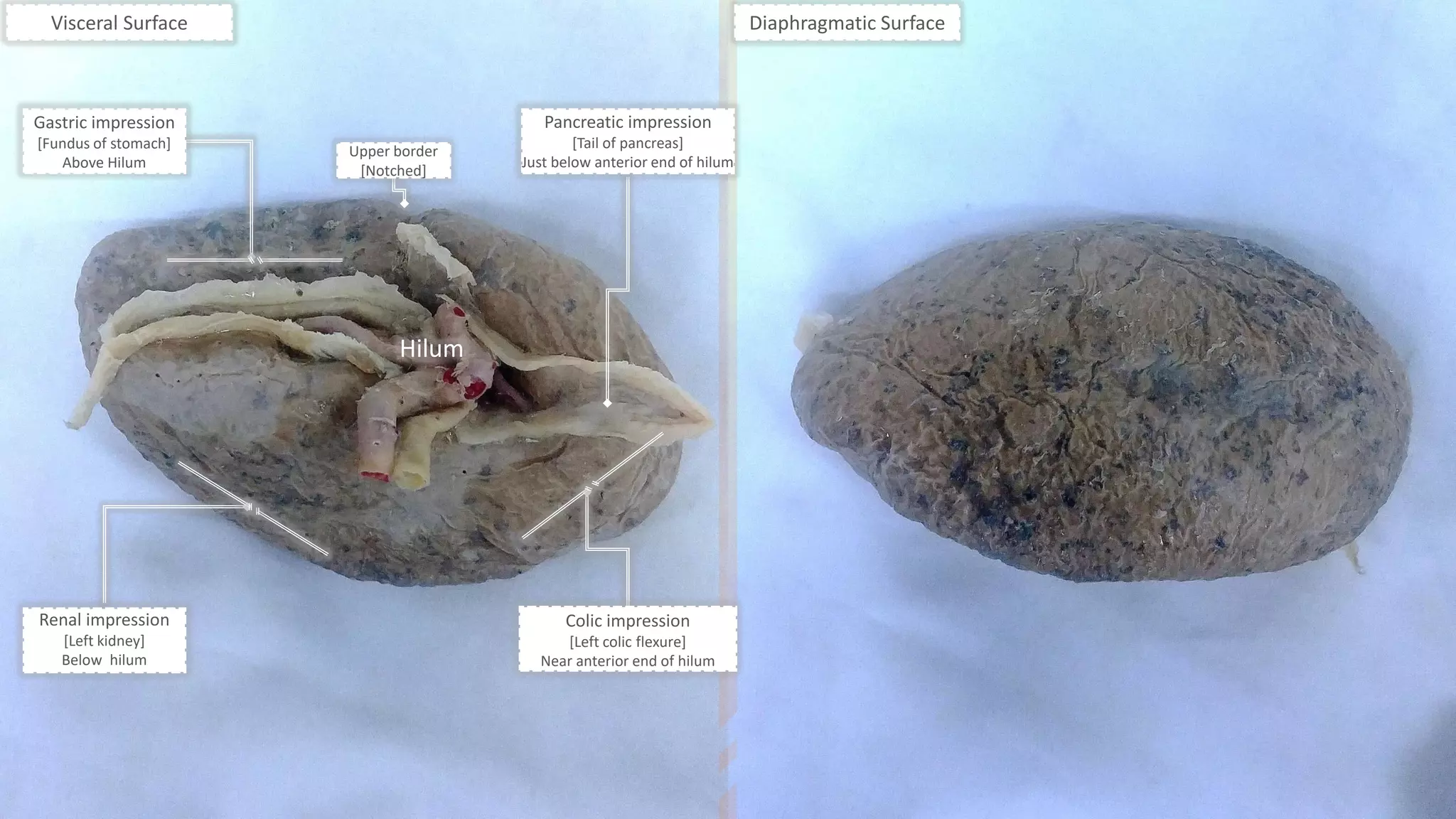 Spleen lab summary | PPT