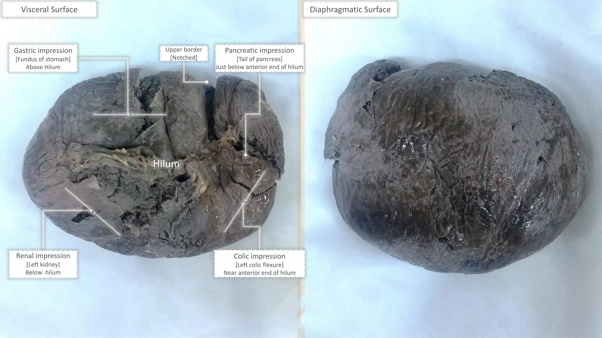 Spleen lab summary | PPT