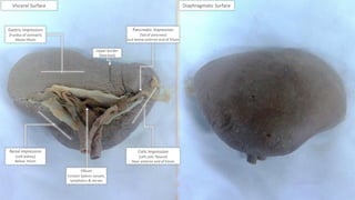 Spleen lab summary | PPT