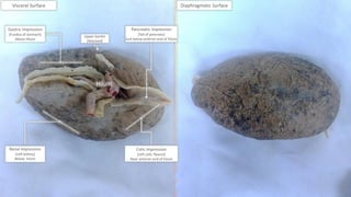 Spleen lab summary | PPT