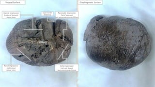 Spleen lab summary | PPT