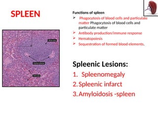 Spleen & Lymph Node Pathophysiology .pptx