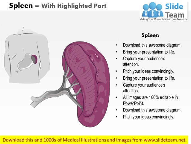 Spleen medical images for power point