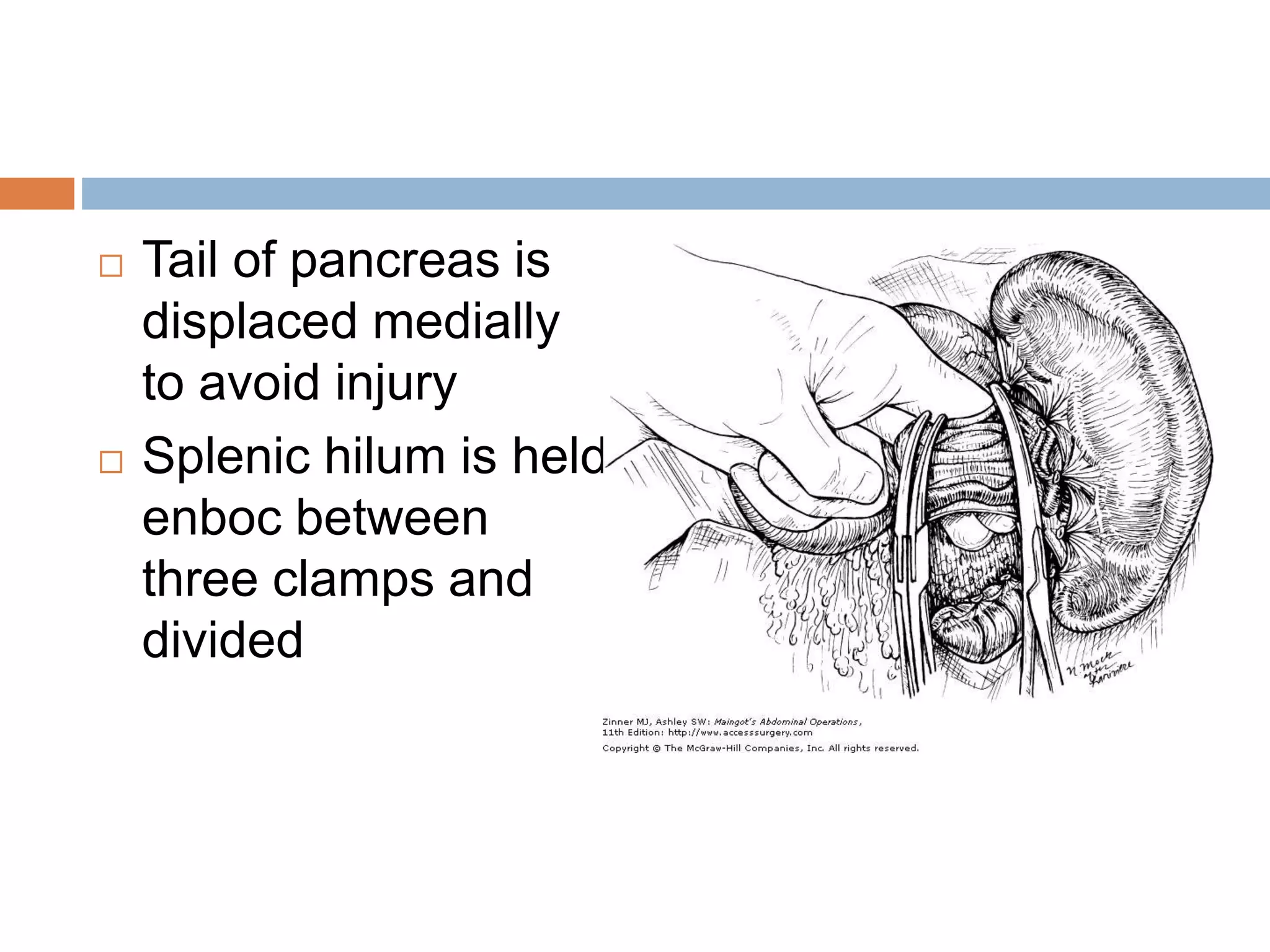Spleenomegaly & hypersplenism etiology pathogenesis and surgical ...