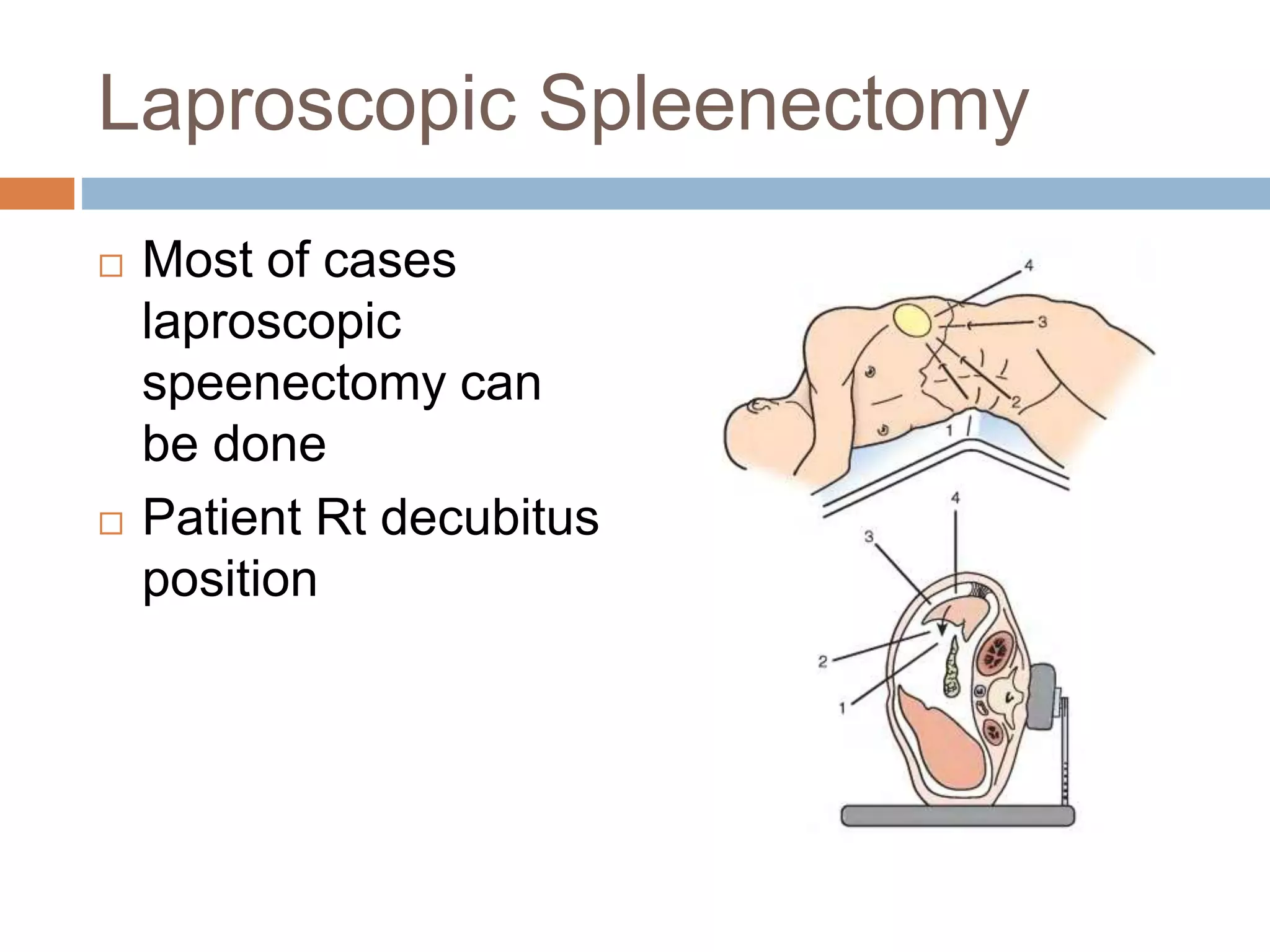 Spleenomegaly & hypersplenism etiology pathogenesis and surgical management | PPTX