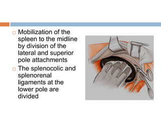 Spleenomegaly & hypersplenism etiology pathogenesis and surgical ...