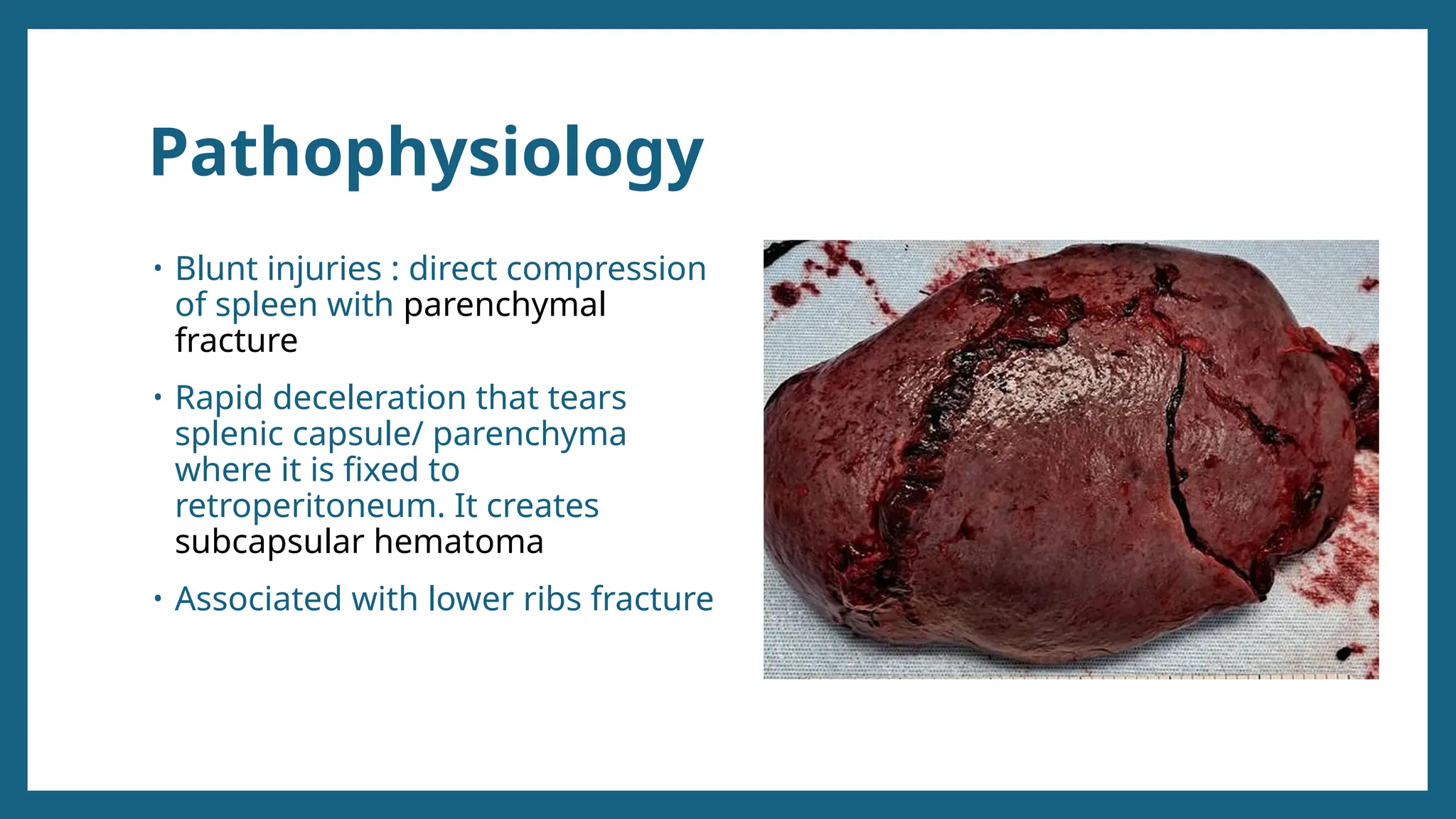 SPLEEN Trauma-Etiology, Investigation, Management .pptx