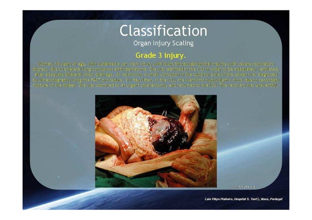 Spleen Trauma Classification | PDF