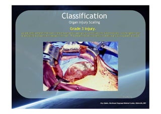 Spleen Trauma Classification | PDF