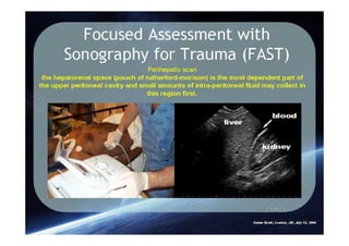 Spleen Trauma Classification | PDF