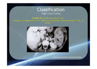 Spleen Trauma Classification | PDF