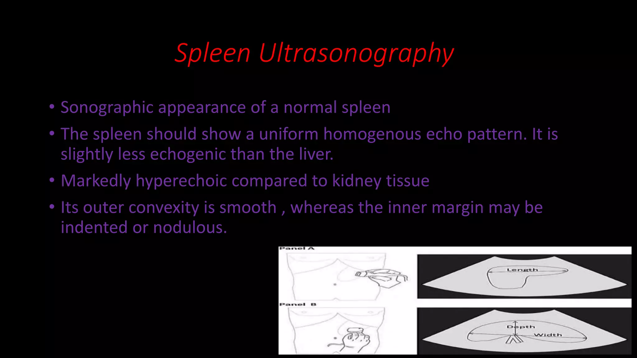 Spleen Ultrasonography PPT.pptx