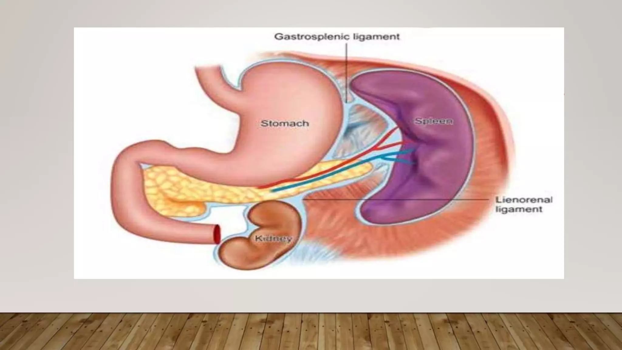 Splenectomy Pptx