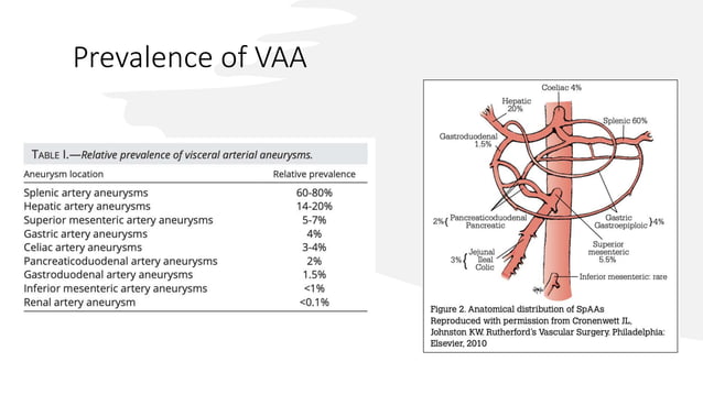 Aneurysms of Visceral arteries, Splenic Artery Aneurysm in Childbearing ...