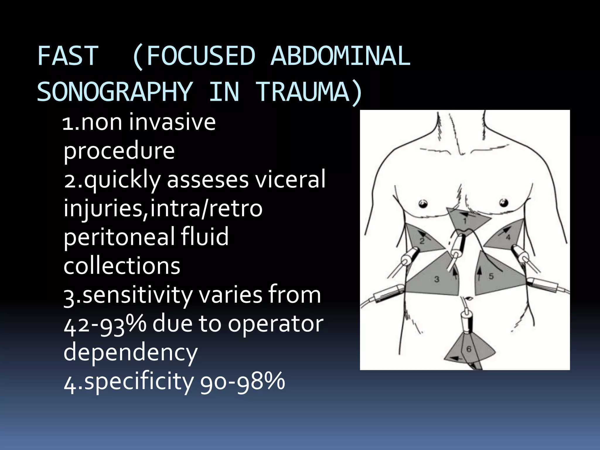 Splenic injuries | PPTX