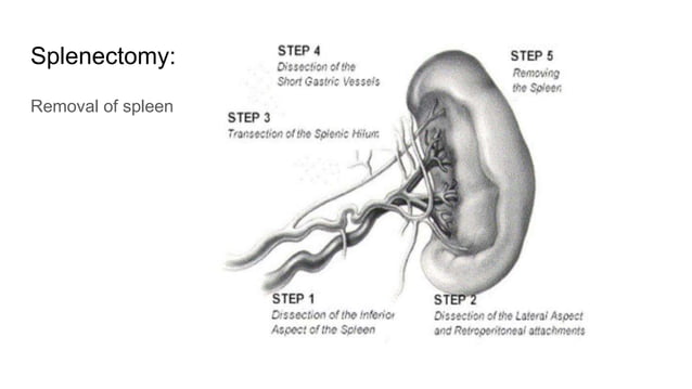 Splenic injuries and their management.pptx