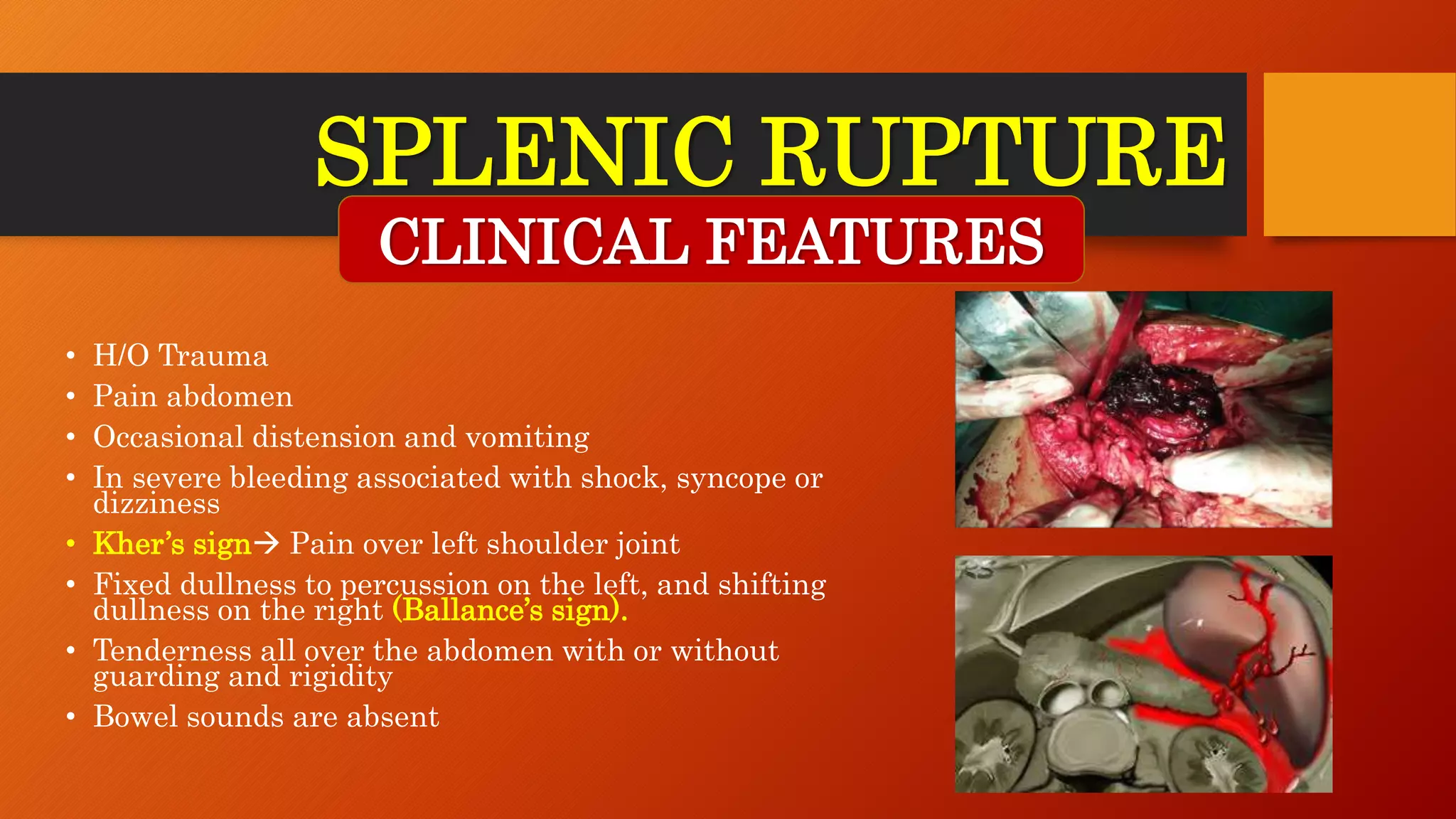 SPLENIC INJURY.pptx | Death, Injury, or Military Conflict | Sensitive ...