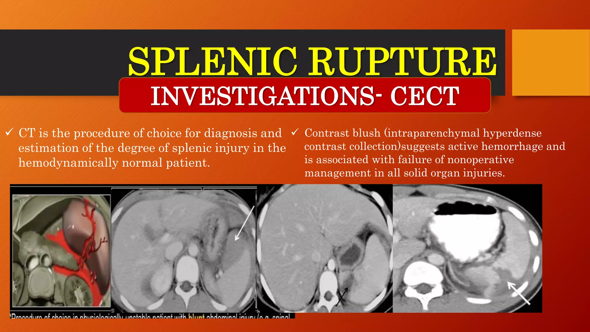 SPLENIC INJURY.pptx