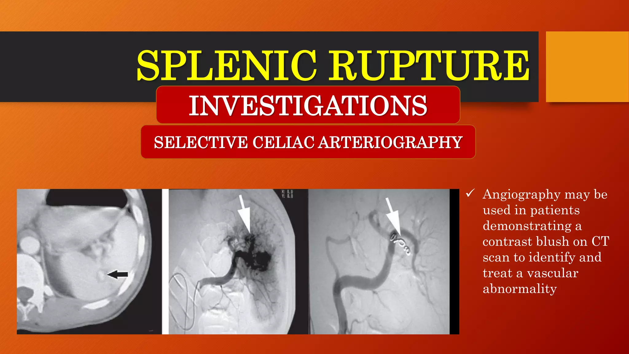 SPLENIC INJURY.pptx | Death, Injury, or Military Conflict | Sensitive ...