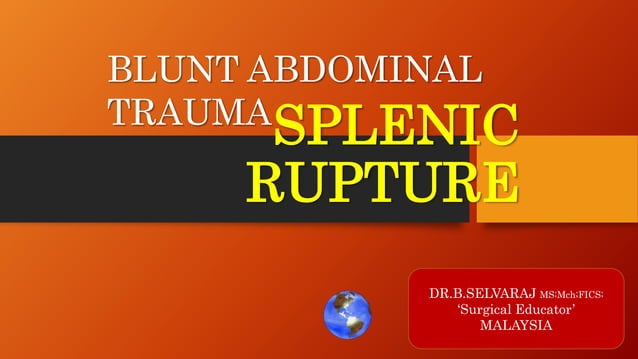 SPLENIC INJURY.pptx | Death, Injury, or Military Conflict | Sensitive ...