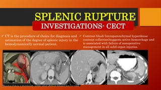 SPLENIC INJURY.pptx | Death, Injury, or Military Conflict | Sensitive ...