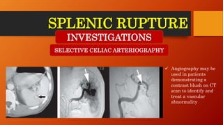 SPLENIC INJURY.pptx