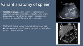 splenic lesions and findings of ct and usg | PPTX
