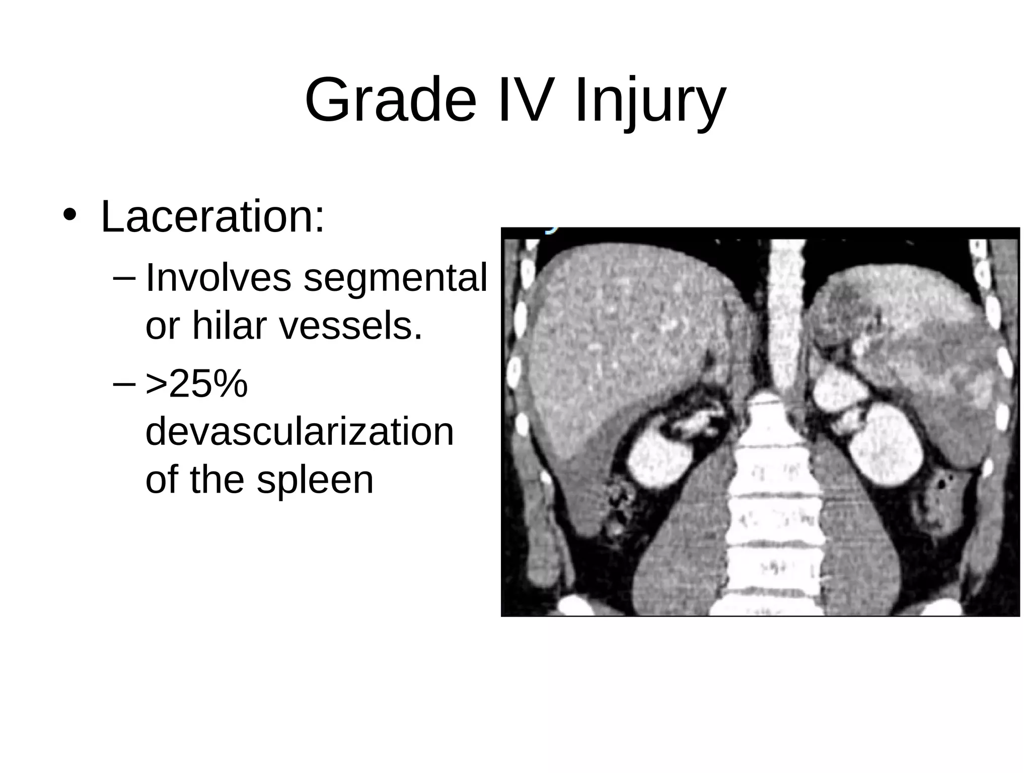 Splenic trauma - Causes, Complications, Management | PDF