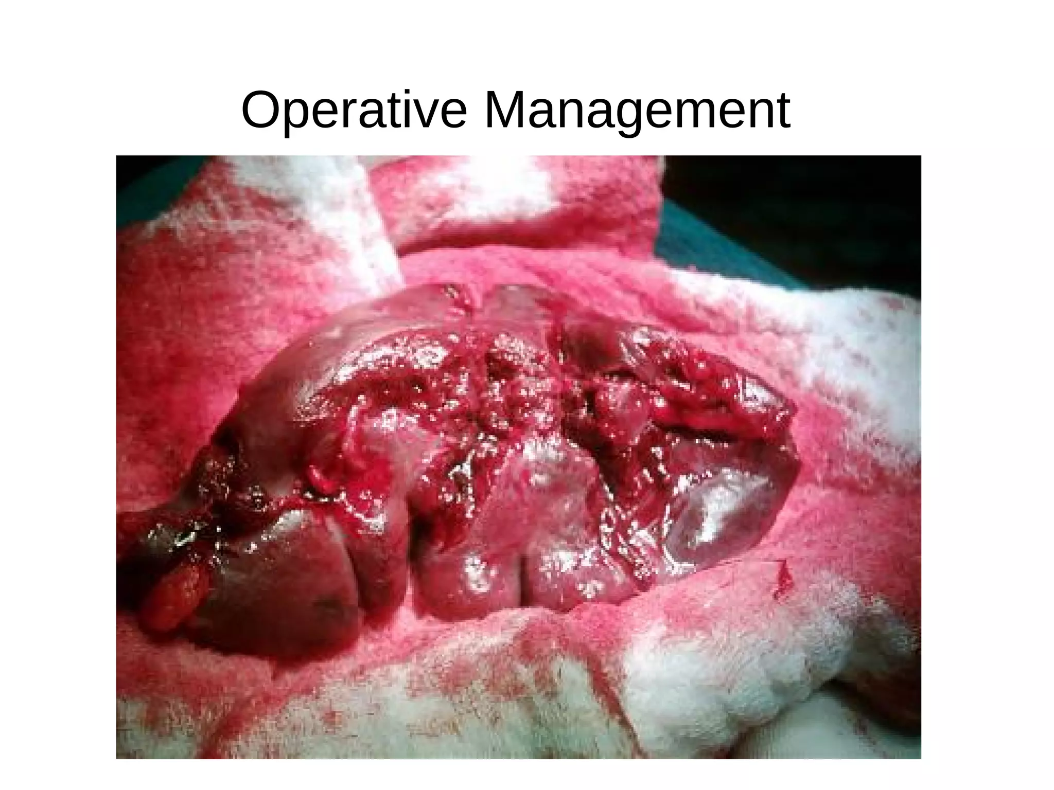 Splenic trauma - Causes, Complications, Management | PDF