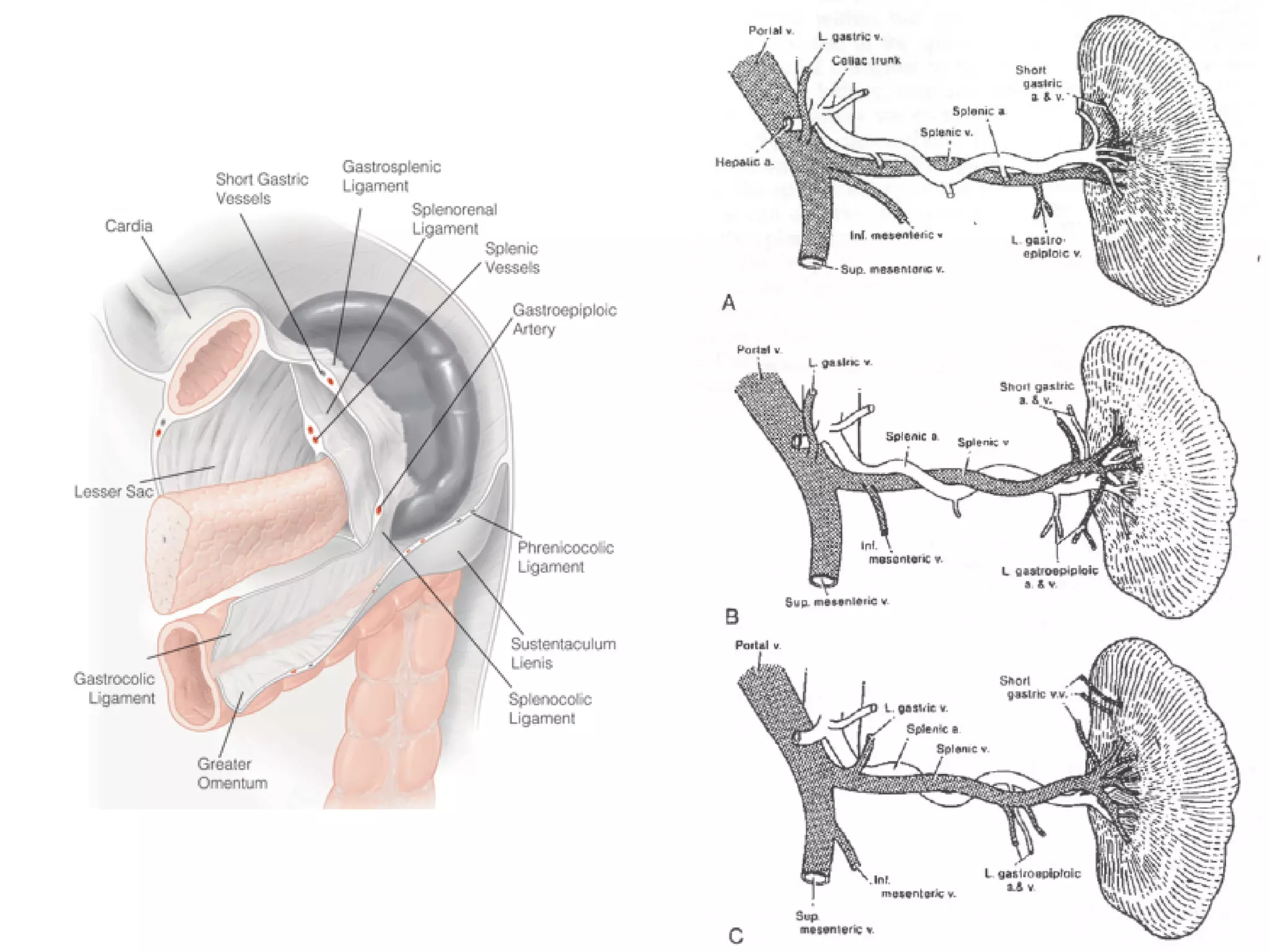 Splenic trauma - Causes, Complications, Management | PDF