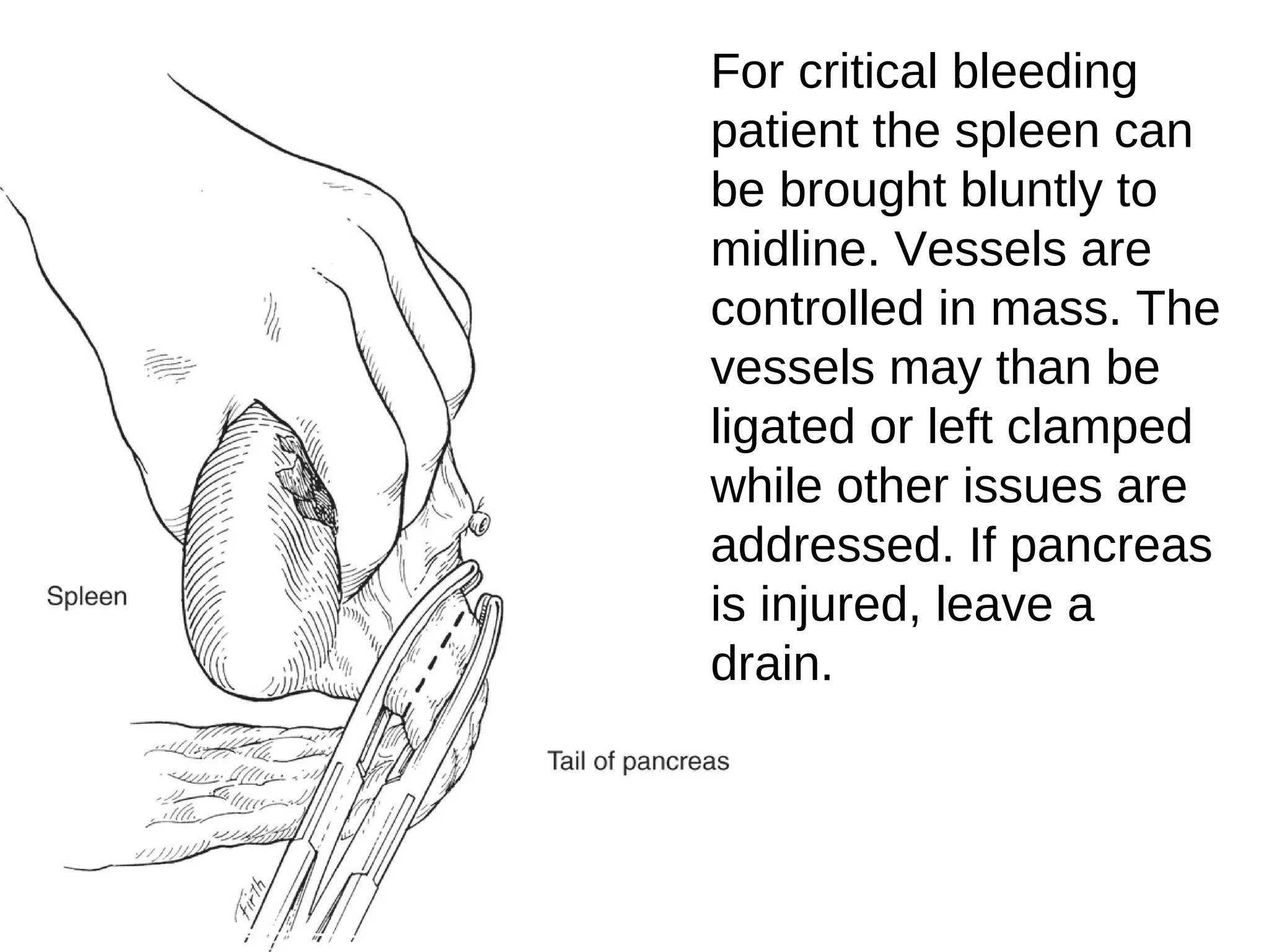 Splenic trauma - Causes, Complications, Management | PDF