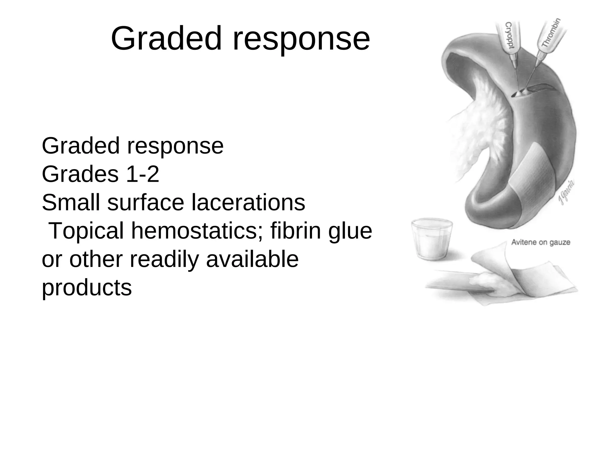 Splenic trauma - Causes, Complications, Management | PDF