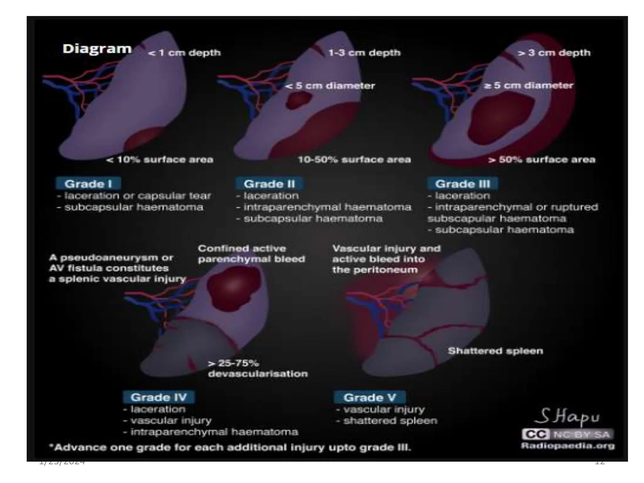 splenic trauma imaging modalities. .pptx