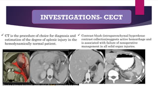 splenic trauma , grading and it's management | PPTX