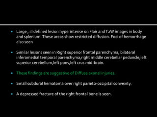 Splenium hyperintensity | PPTX