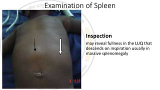 approach to splenomegaly | PPT