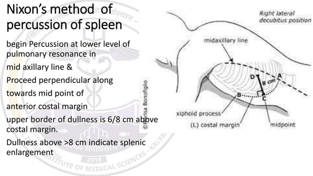 approach to splenomegaly | PPT