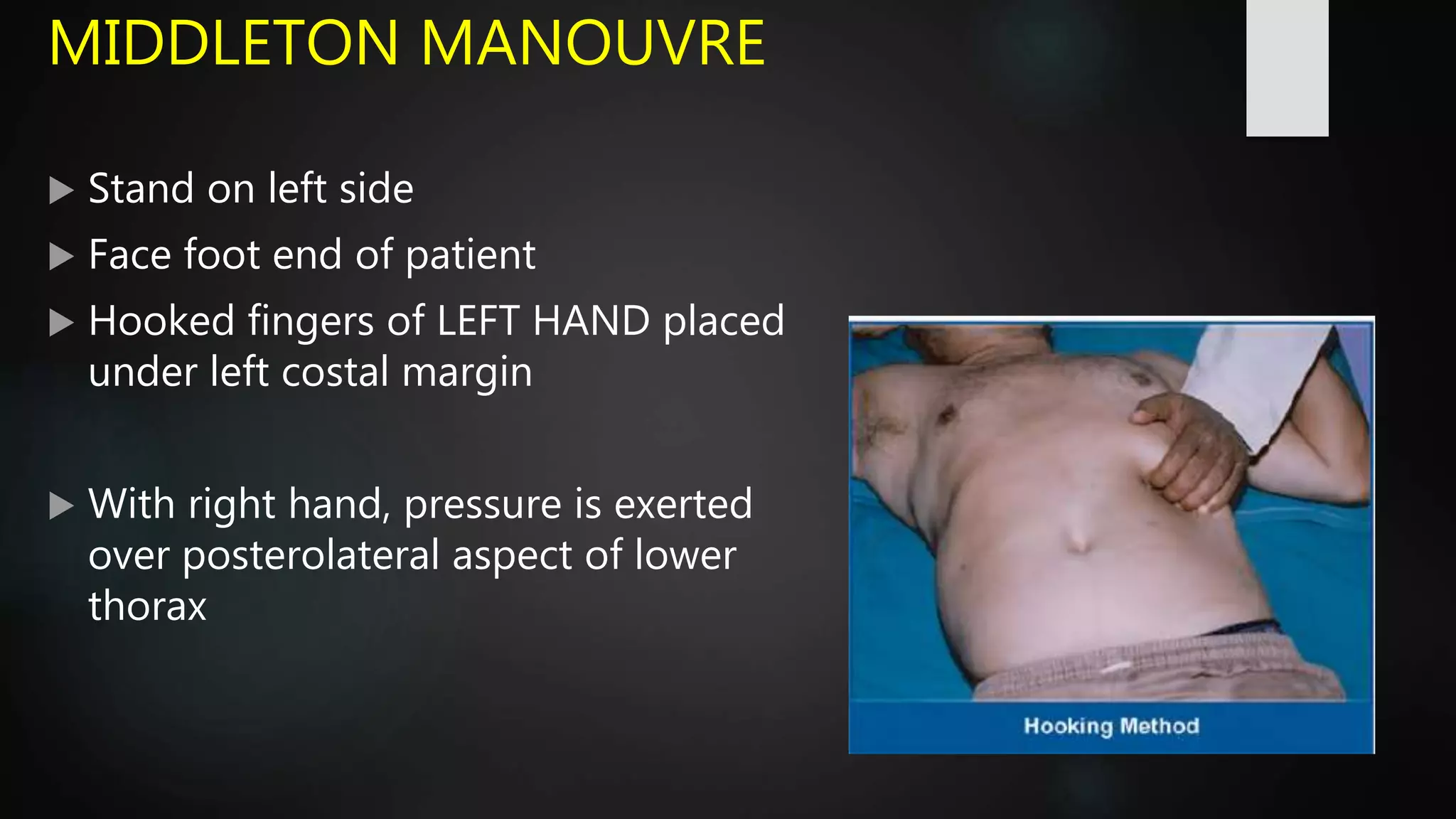Splenomegaly : causes , clinical approach and examination | PPTX