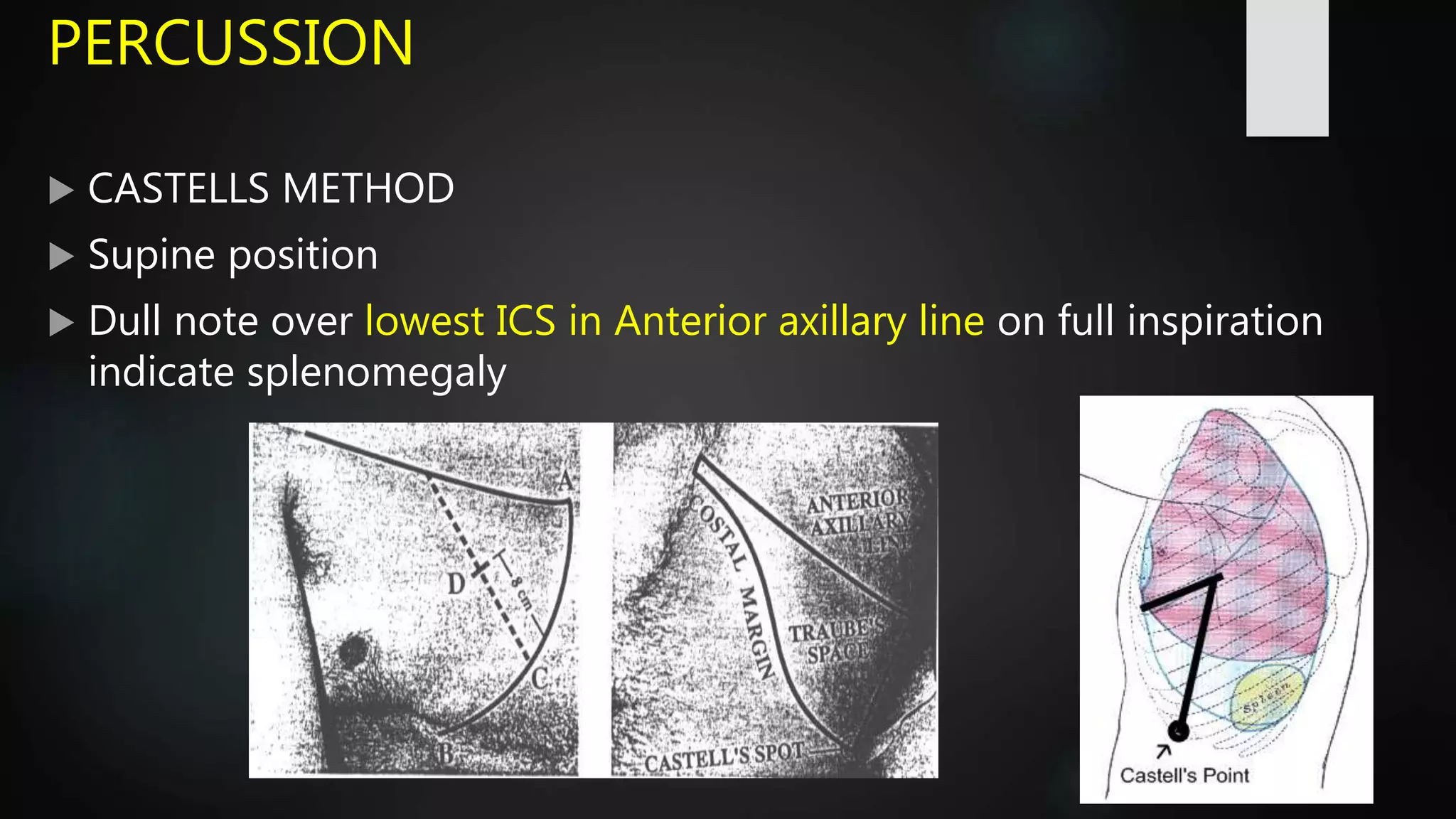 Splenomegaly : causes , clinical approach and examination | PPTX