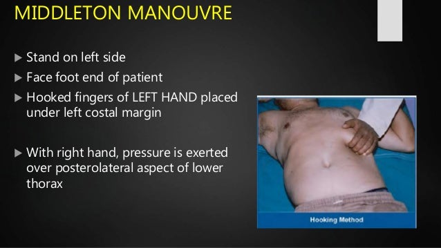 Splenomegaly : causes , clinical approach and examination