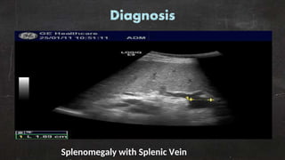 splenomegaly radiology -180319023541.ppt